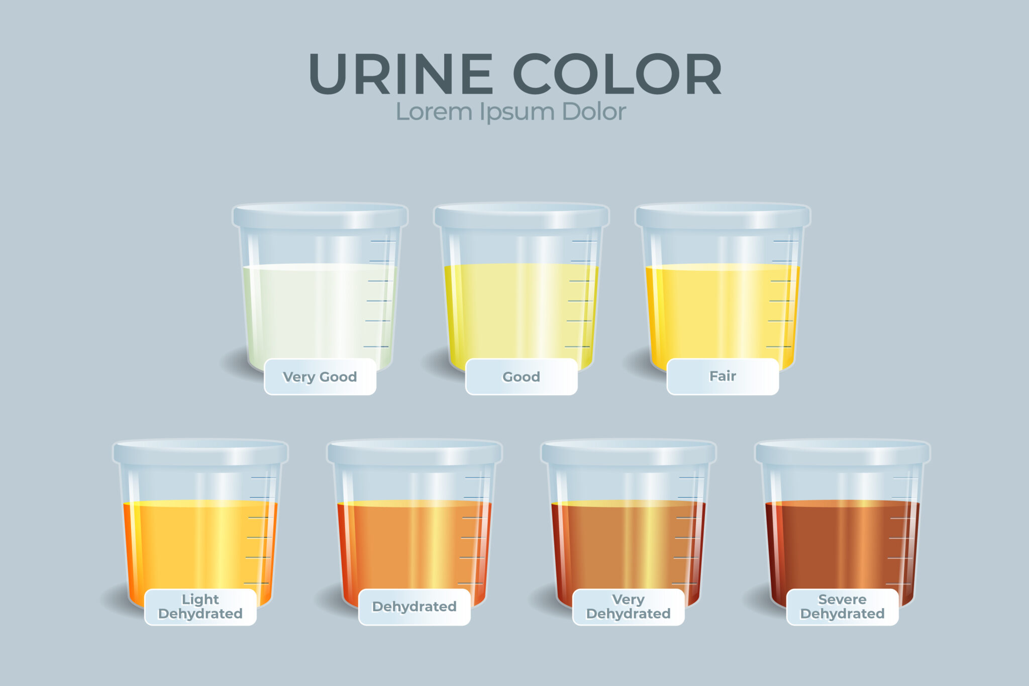 Urine Test: Key Insights from Your Urine Sample - SEMed
